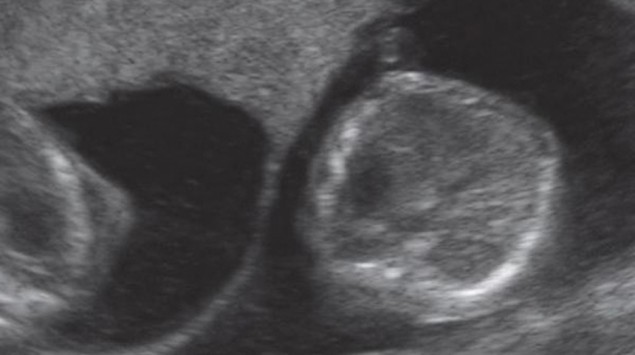 9. SSW (Schwangerschaftswoche) - Onmeda.de