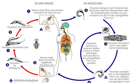 Chagas-Krankheit: Symptome - Onmeda.de